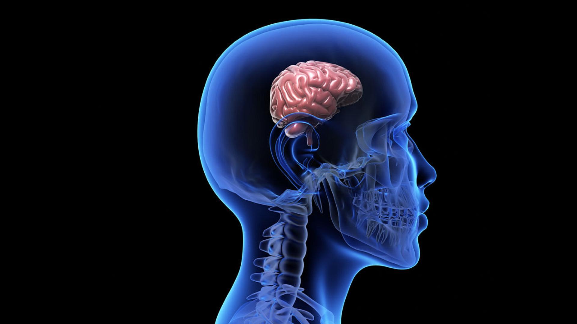 Медицинско чудо: Момиче, родено без мозък, навърши 20 години|Vesti.bg